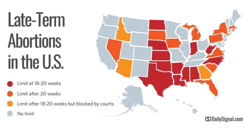 Where Does Your State Stand on Late-Term Abortions?